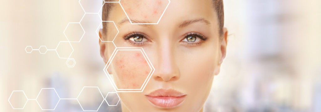 Définition, utilité… tout sur le peeling à Montpellier